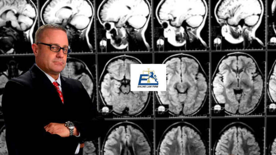 Woodland Hills Brain Injury Attorney